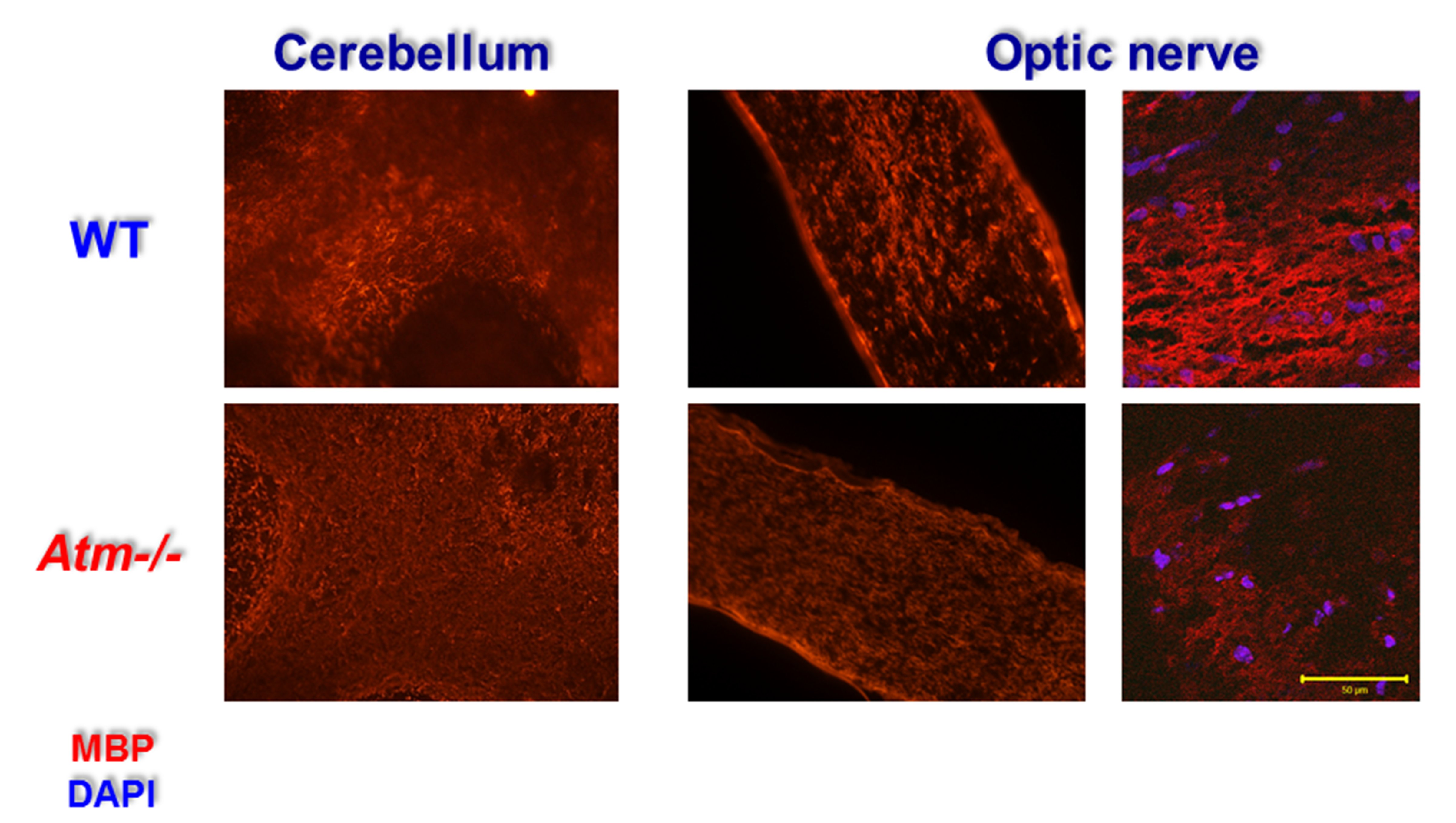 The Role of Malfunctioning DNA Damage Response (DDR) in Brain Degeneration | Opera Medica et ...
